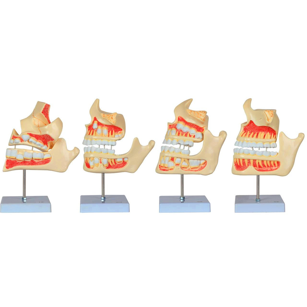 Child Teeth Dentition Development Model | Buyamag – Buyamag INC