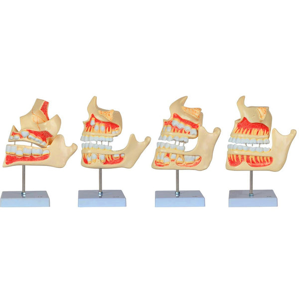 Child Teeth Dentition Development Model | Buyamag – Buyamag INC