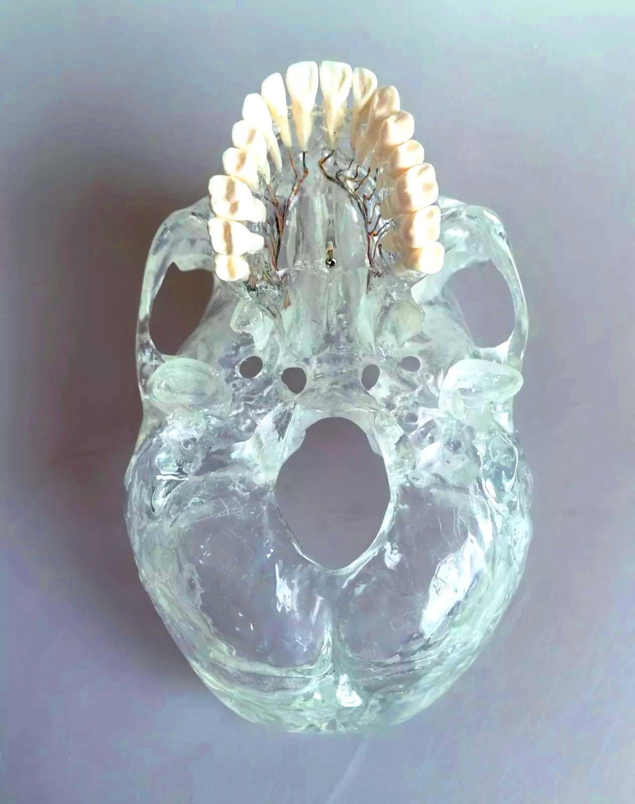 Dental Clear Skull Maxillary Model- Sinuses Buyamag – Buyamag INC