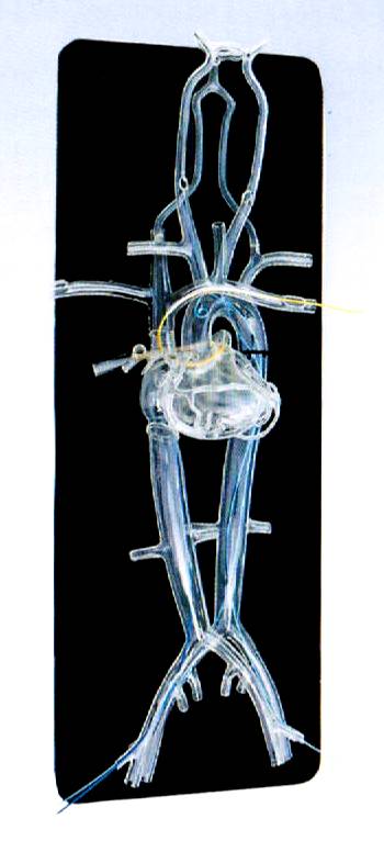 Heart Catheter Stent Pacemaker Model Simulator | Buyamag – Buyamag INC