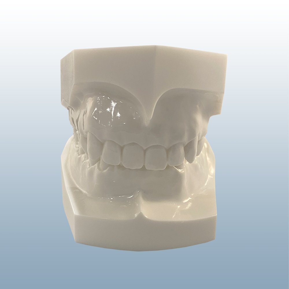 Orthodontic Models : Malocclusion Kit 10- Buyamag – Buyamag INC