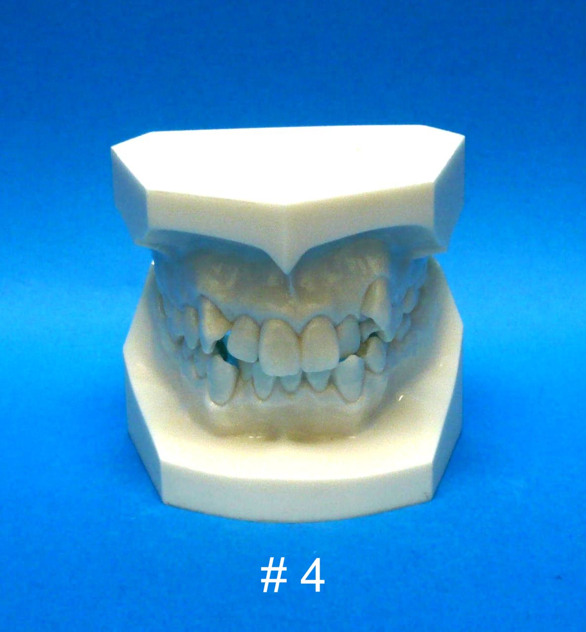 Orthodontic Models : Malocclusion Kit 10- Buyamag – Buyamag INC