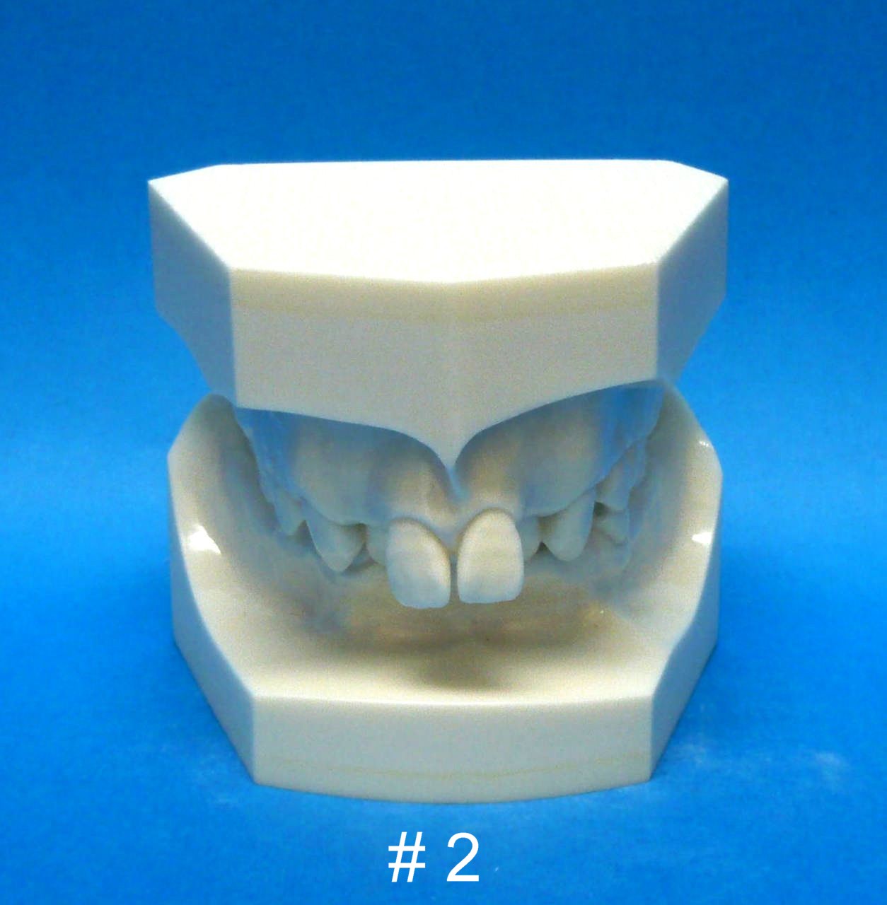 Orthodontic Models : Malocclusion Kit 10- Buyamag – Buyamag INC