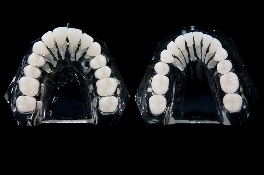 Orthdontic Typodont Model For Clear Aligners: Buyamag – Buyamag INC