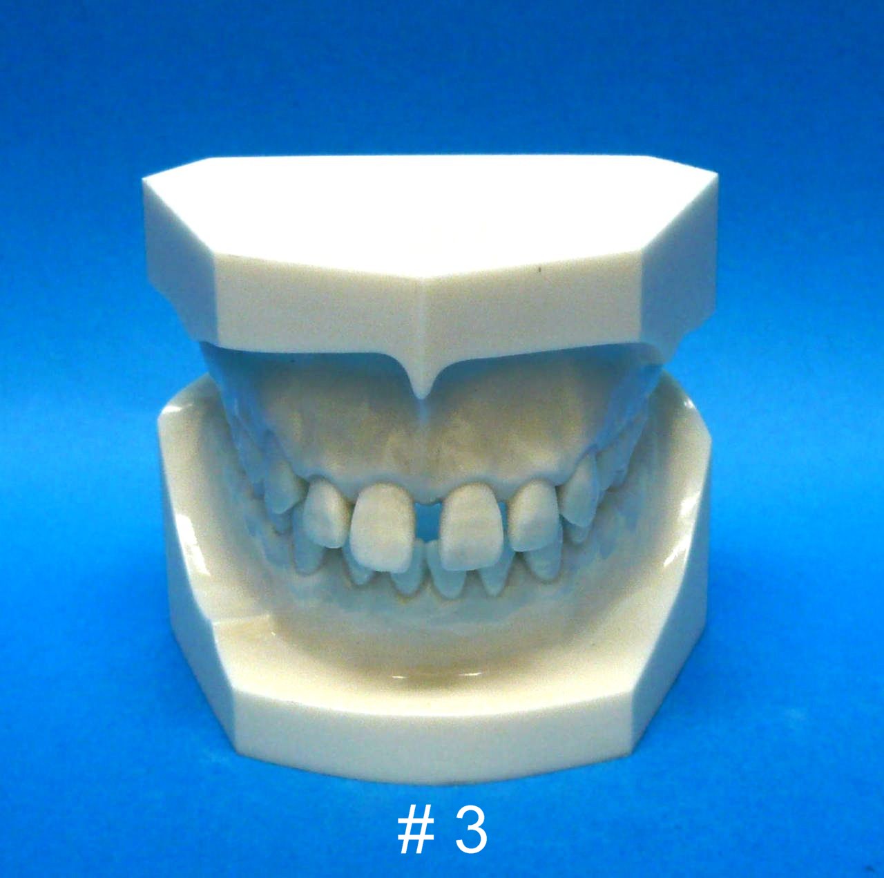 Orthodontic Models : Malocclusion Kit 10- Buyamag – Buyamag INC