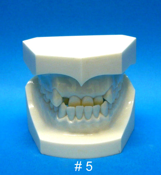 Orthodontic Models Malocclusion Demonstration- Buyamag – Buyamag INC