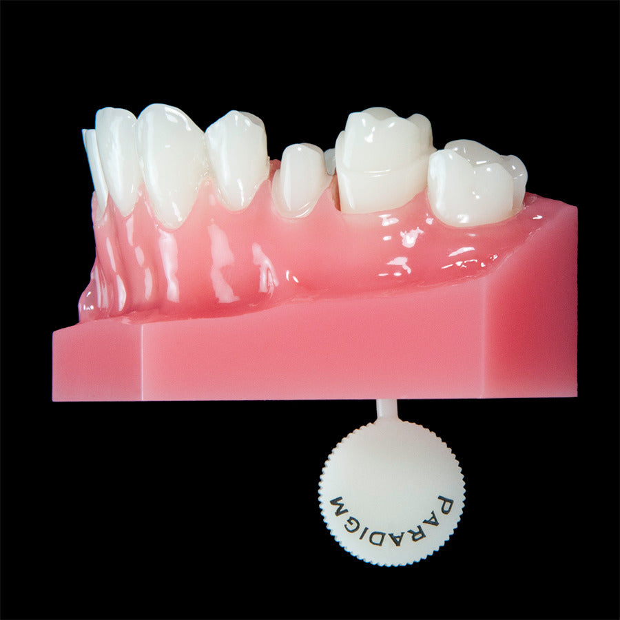 Prepped Teeth Crown- Bridge Remove Dies: Buyamag – Buyamag INC
