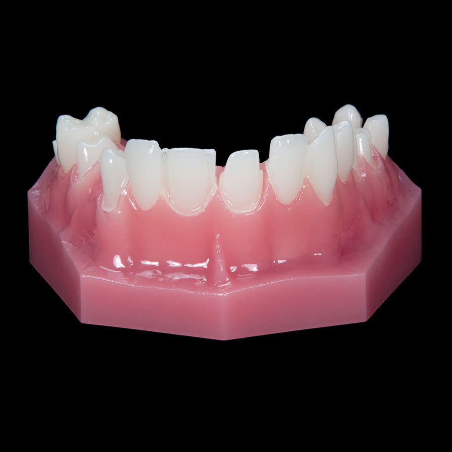 Prepped Teeth Crown- Bridge Remove Dies: Buyamag – Buyamag INC