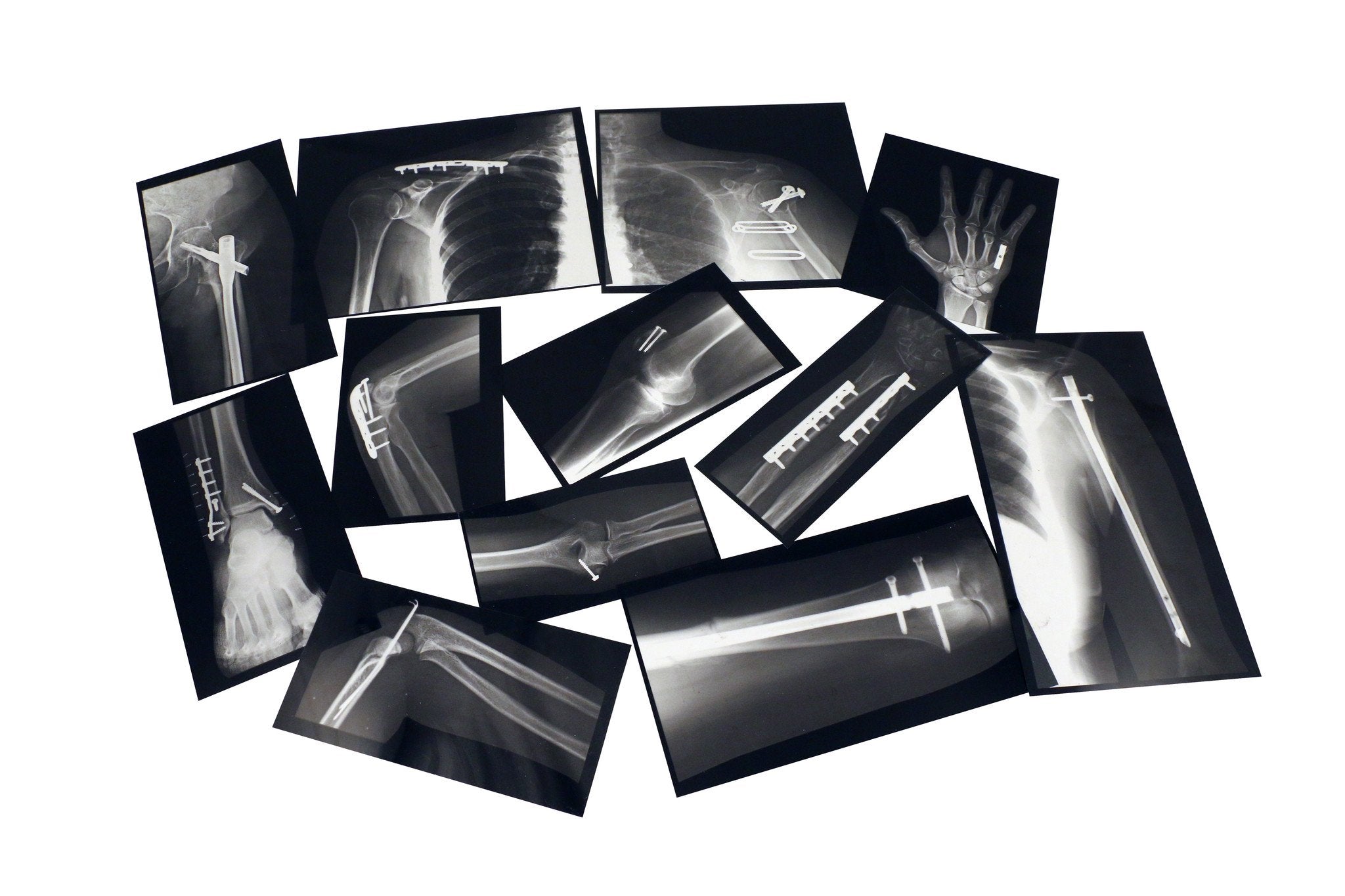 Fixed Bones X-Ray Human Images Hardware Buyamag – Buyamag INC