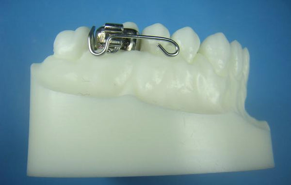 Anterior Bite Plate: Retainer Model | Buyamag – Buyamag INC