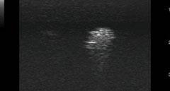 Breast Phantom Ultrasound Examination Simulator Model – Buyamag INC