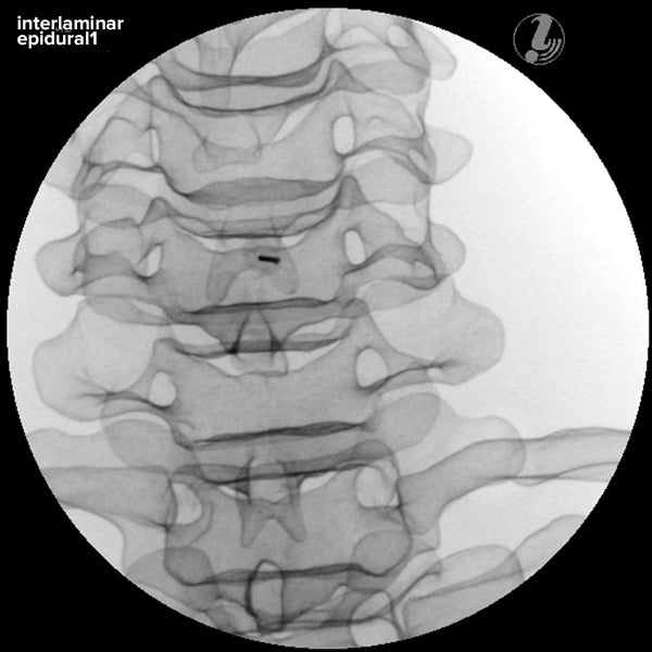 Cervical Spine Injection Model: Image Guided – Buyamag INC