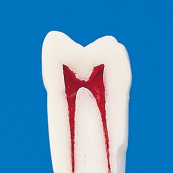 Permanent Endodontic Teeth Practice Models- Buyamag – Buyamag INC