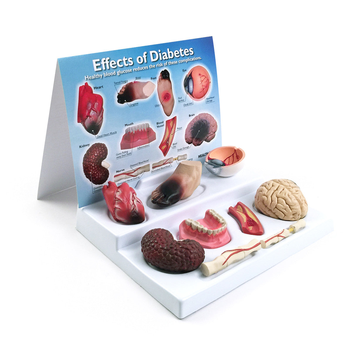 Diabetes Model Organs | Effects - Display Buyamag – Buyamag INC