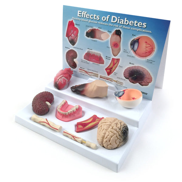 Diabetes Model Organs | Effects - Display Buyamag – Buyamag INC