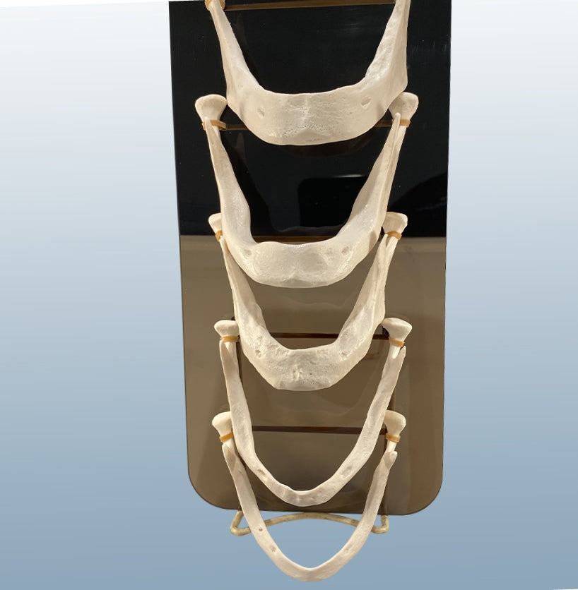 Dental Edentulous Model- Mandible Atrophy Buyamag – Buyamag INC