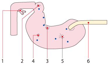 Endoscopy ERCP Exam : Simulator Manikin – Buyamag INC
