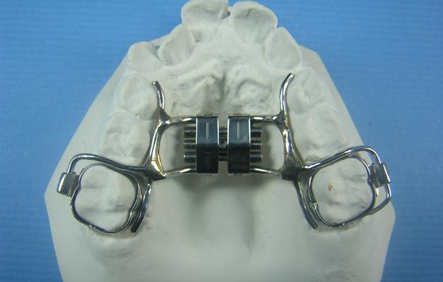 Freedom-Lock System Retainer Model- Buyamag – Buyamag INC