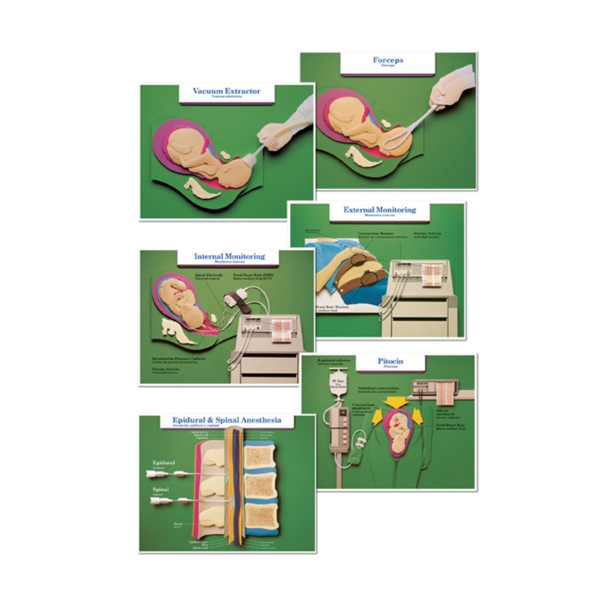 Childbirth Labor Birth Intervention Charts – Buyamag INC