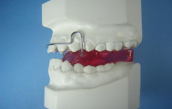 Bionator Close Orthodontic Model Model | Buyamag – Buyamag INC