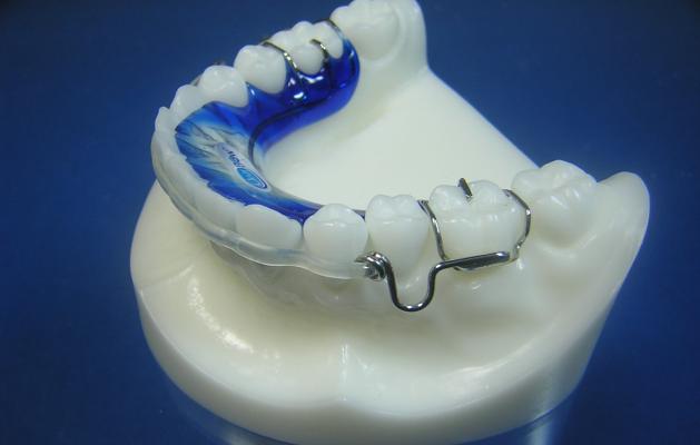 ClearBow Orthodontic Retainer Appliance Model: Buyamag – Buyamag INC