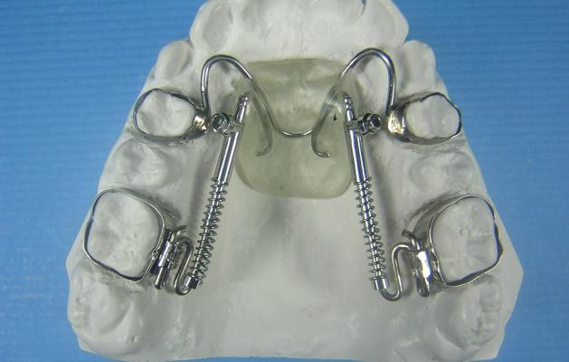 Distal-Jet Distalizer Orthodontic Model | Buyamag – Buyamag INC