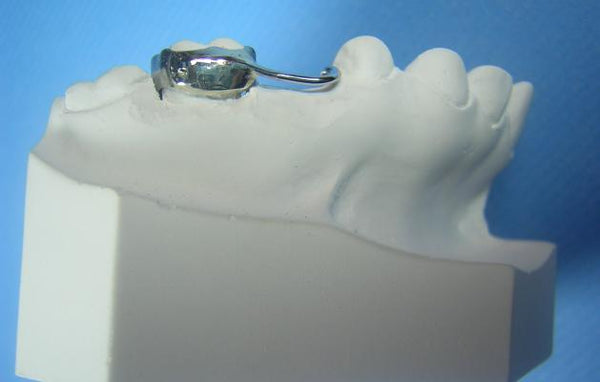 Space Maintainer Orthodontic Model – Buyamag INC