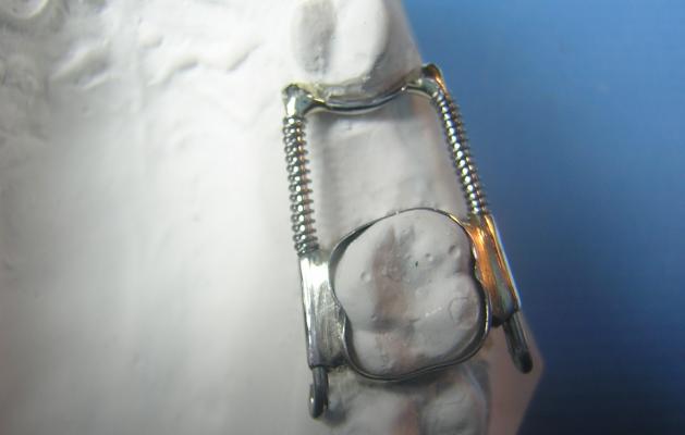 Space Regainer Orthodontic Model – Buyamag INC