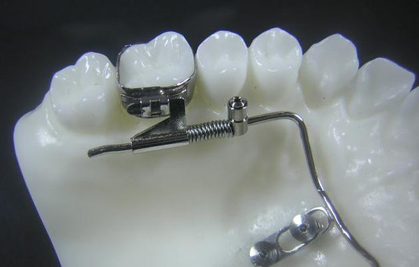 Temporary Anchorage Devices TAD Orthodontic Model #1 – Buyamag INC