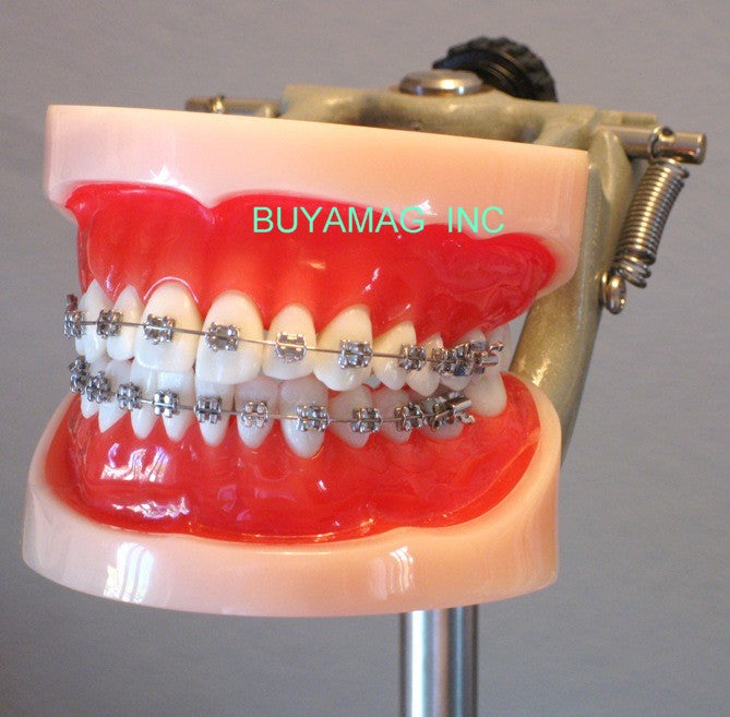 Orthodontic Models: Ligature Tying Typodont Buyamag – Buyamag INC