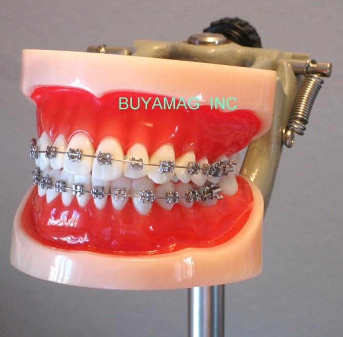 Orthodontic Models | Ligature Tying Typodont – Buyamag INC