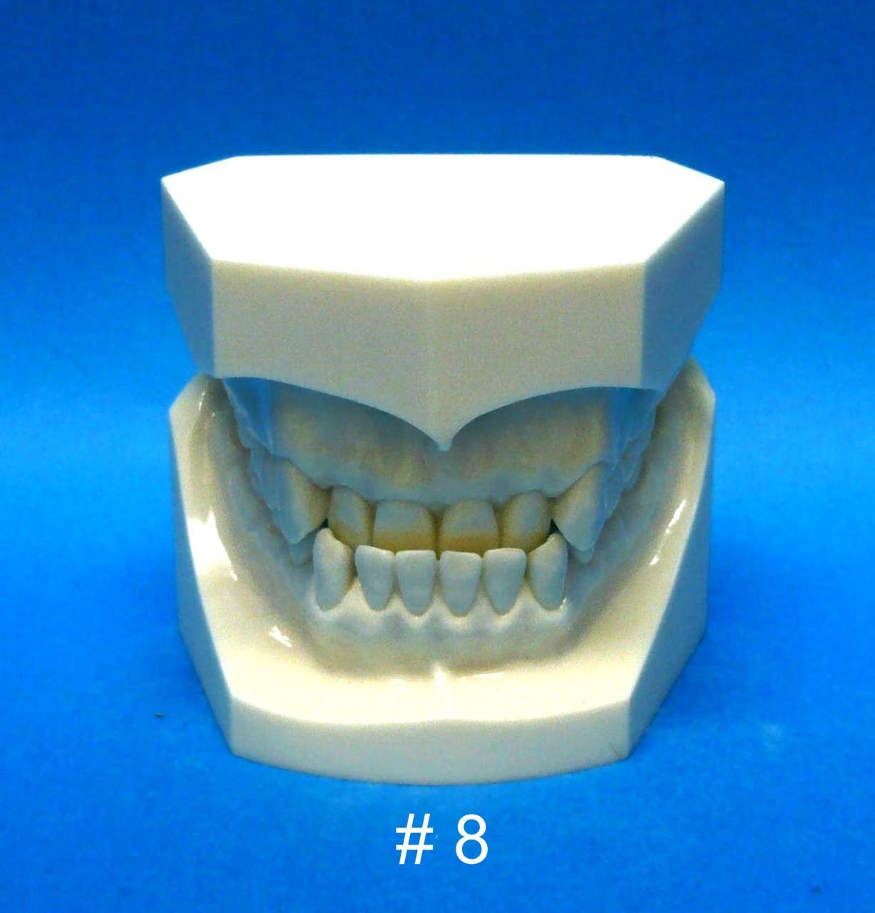 Orthodontic Models : Malocclusion Kit 10- Buyamag – Buyamag INC
