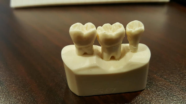 Periodontal Hygiene Sextant Three Tooth Model Buyamag – Buyamag INC