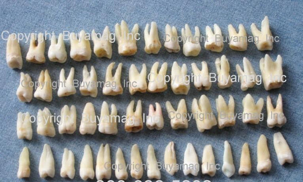 Real Human Teeth - For Sale Molars: inc – Buyamag INC