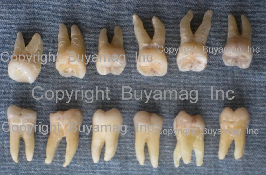 Real Human Teeth - For Sale Molars: inc – Buyamag INC