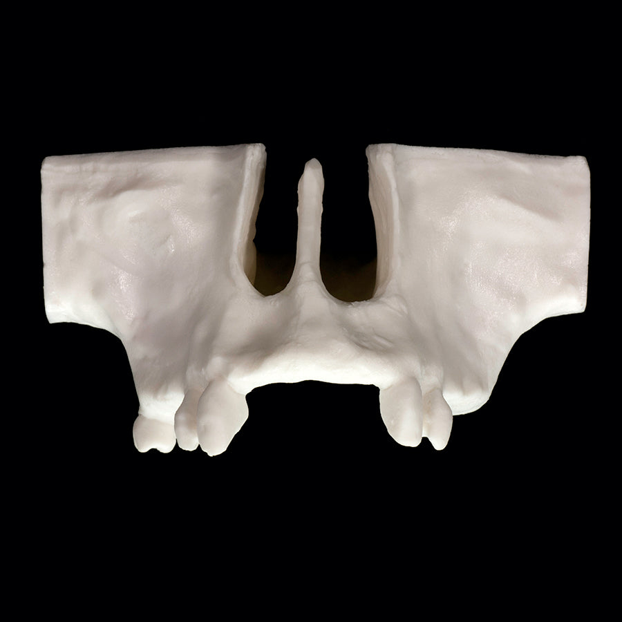 Dental Sinus Lift - Surgery Model Implant Buyamag – Buyamag INC