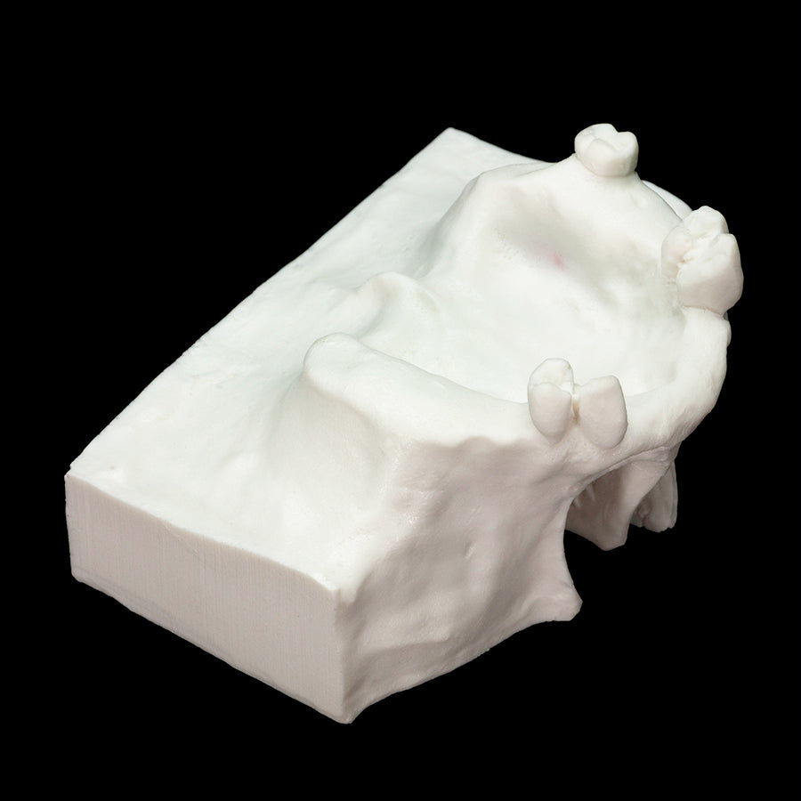 Dental Sinus Lift - Surgery Model Implant Buyamag – Buyamag INC