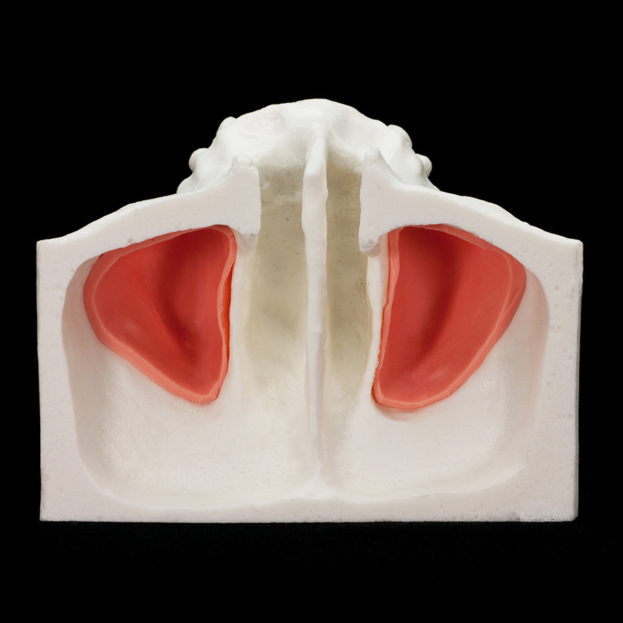 Dental Sinus Lift - Surgery Model Implant Buyamag – Buyamag INC