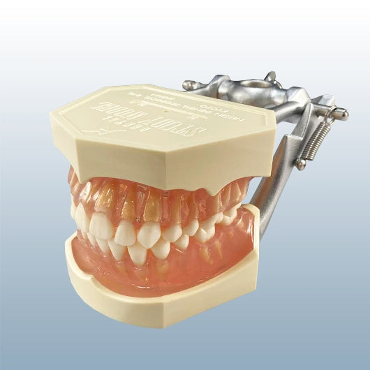 Tooth Extraction Model | Practice Training Buyamag – Buyamag INC