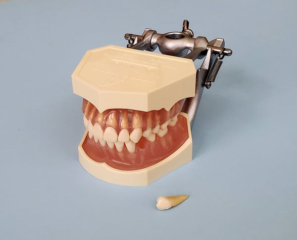 Tooth Extraction Model | Practice Training Buyamag – Buyamag INC